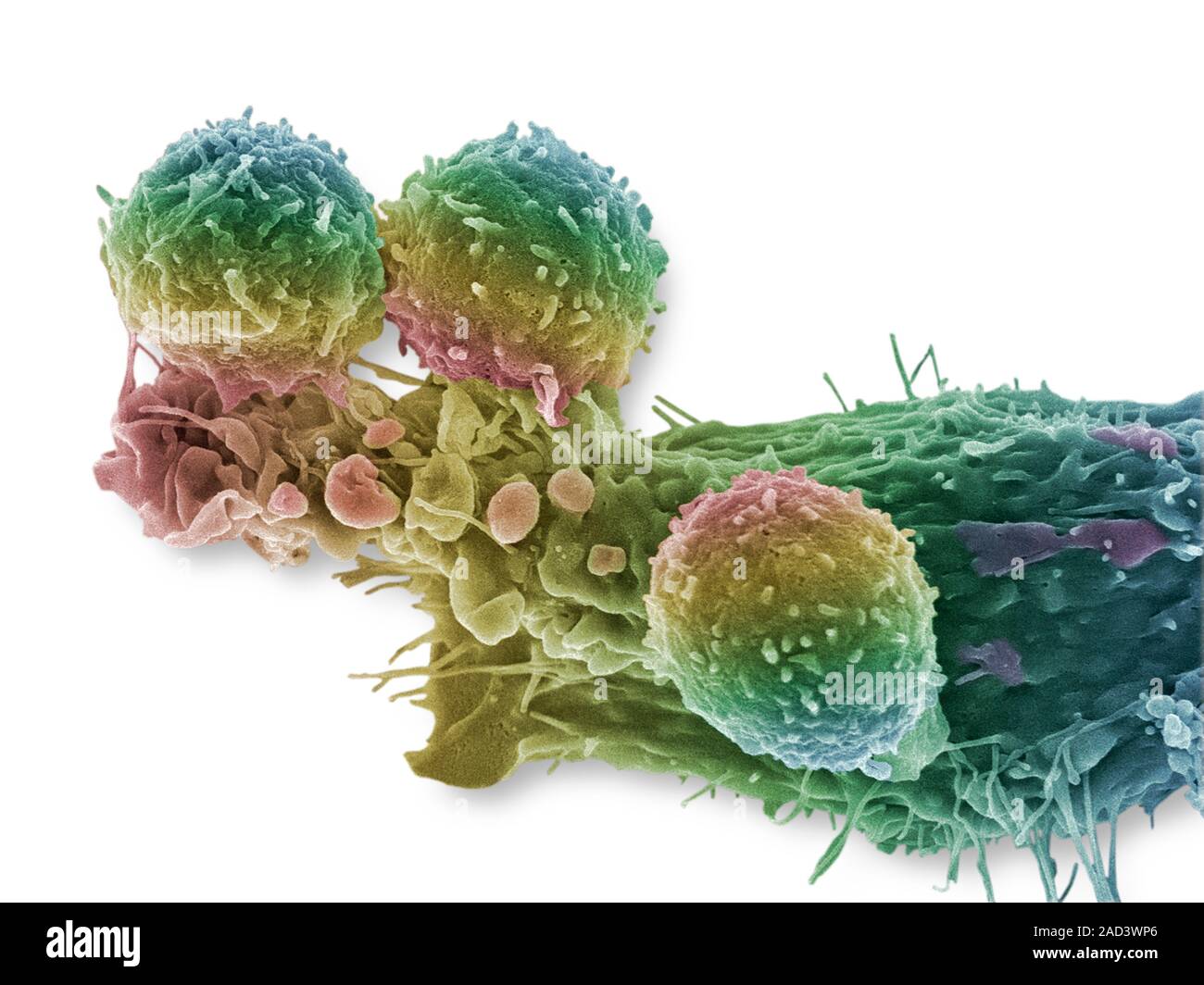 Les lymphocytes T et les cellules du cancer. Couleur de l'analyse des ...