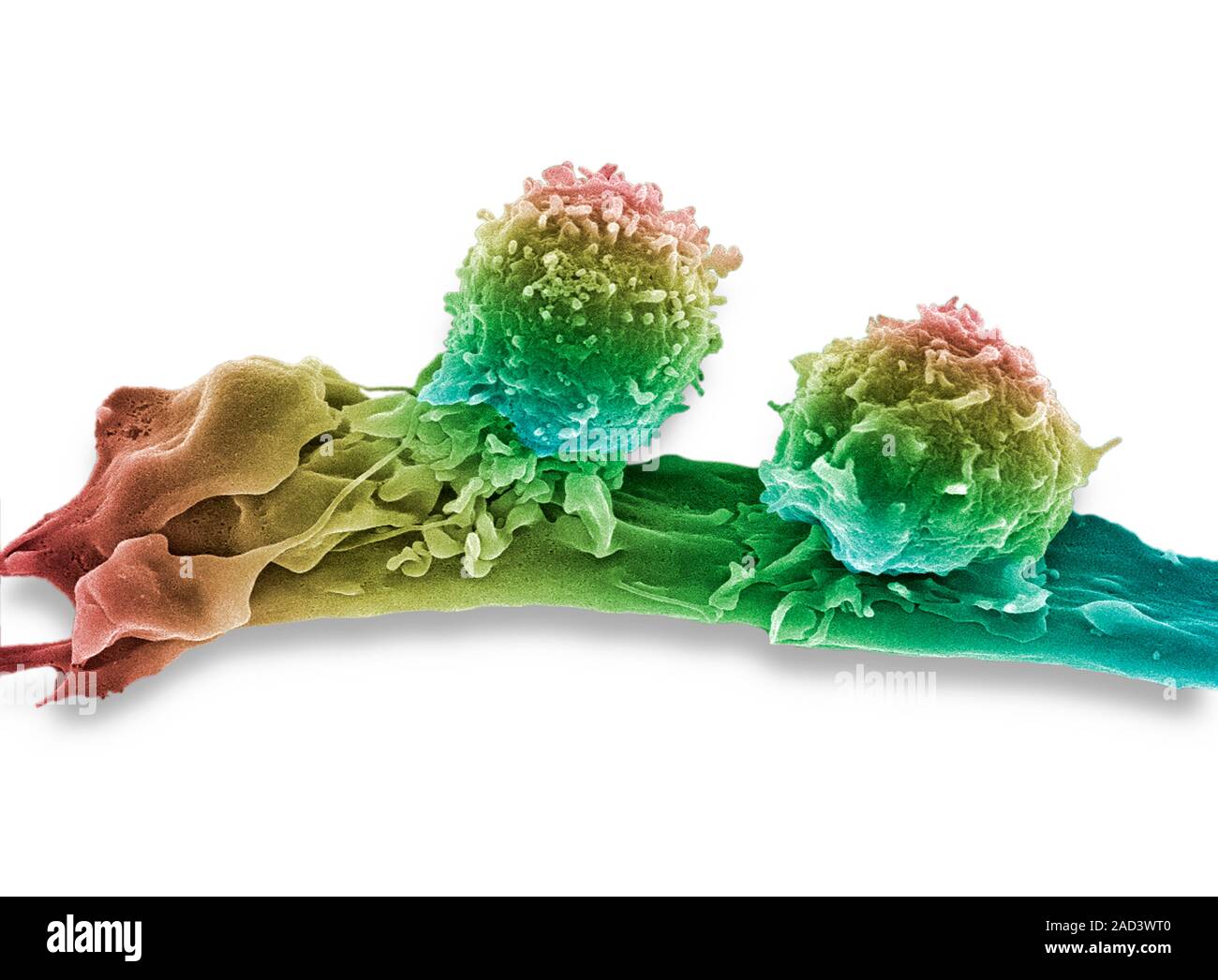 Les lymphocytes T et les cellules du cancer. Couleur de l'analyse des ...