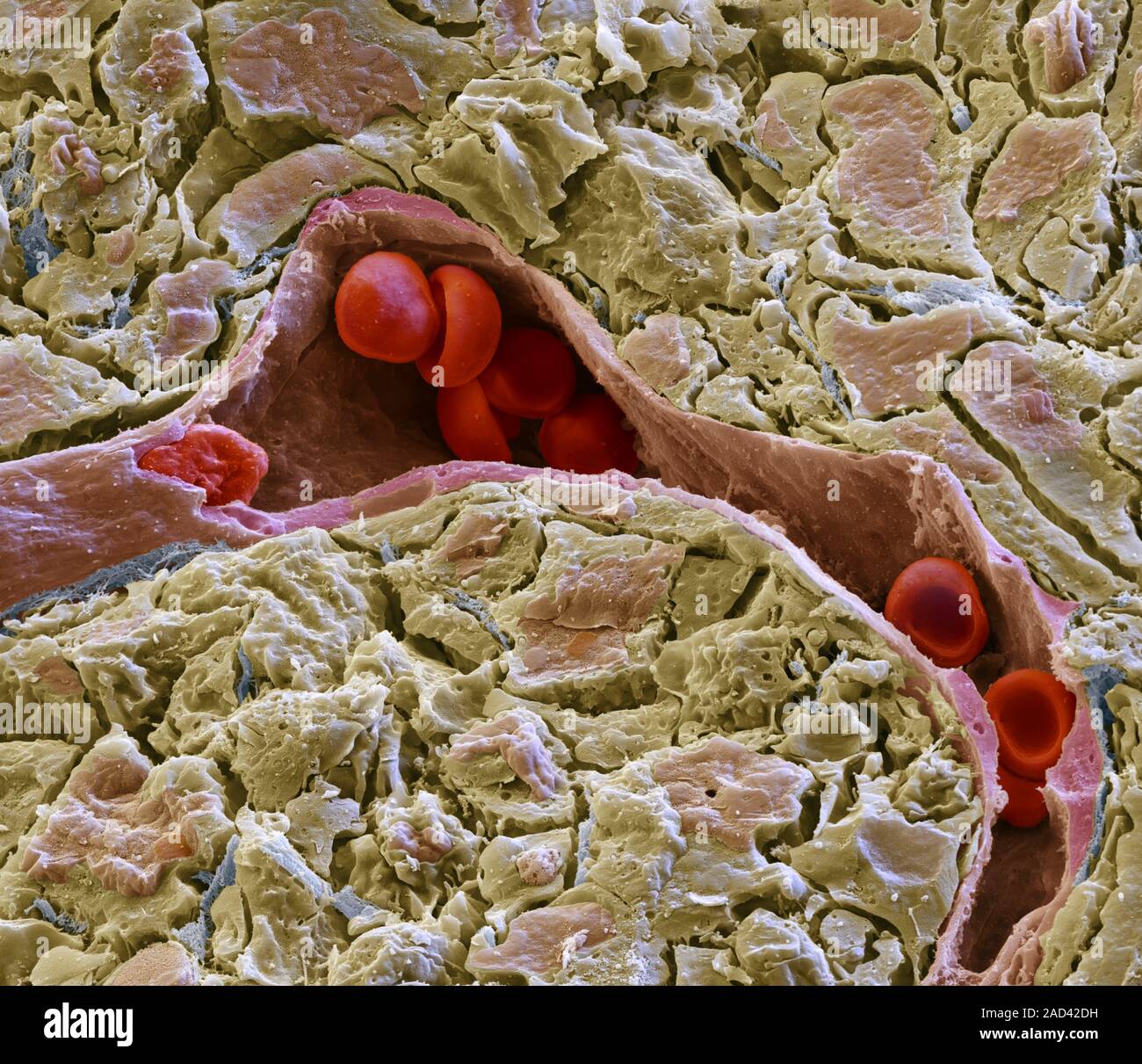 Et capillaire des globules rouges. Couleur de l'analyse des électrons ...