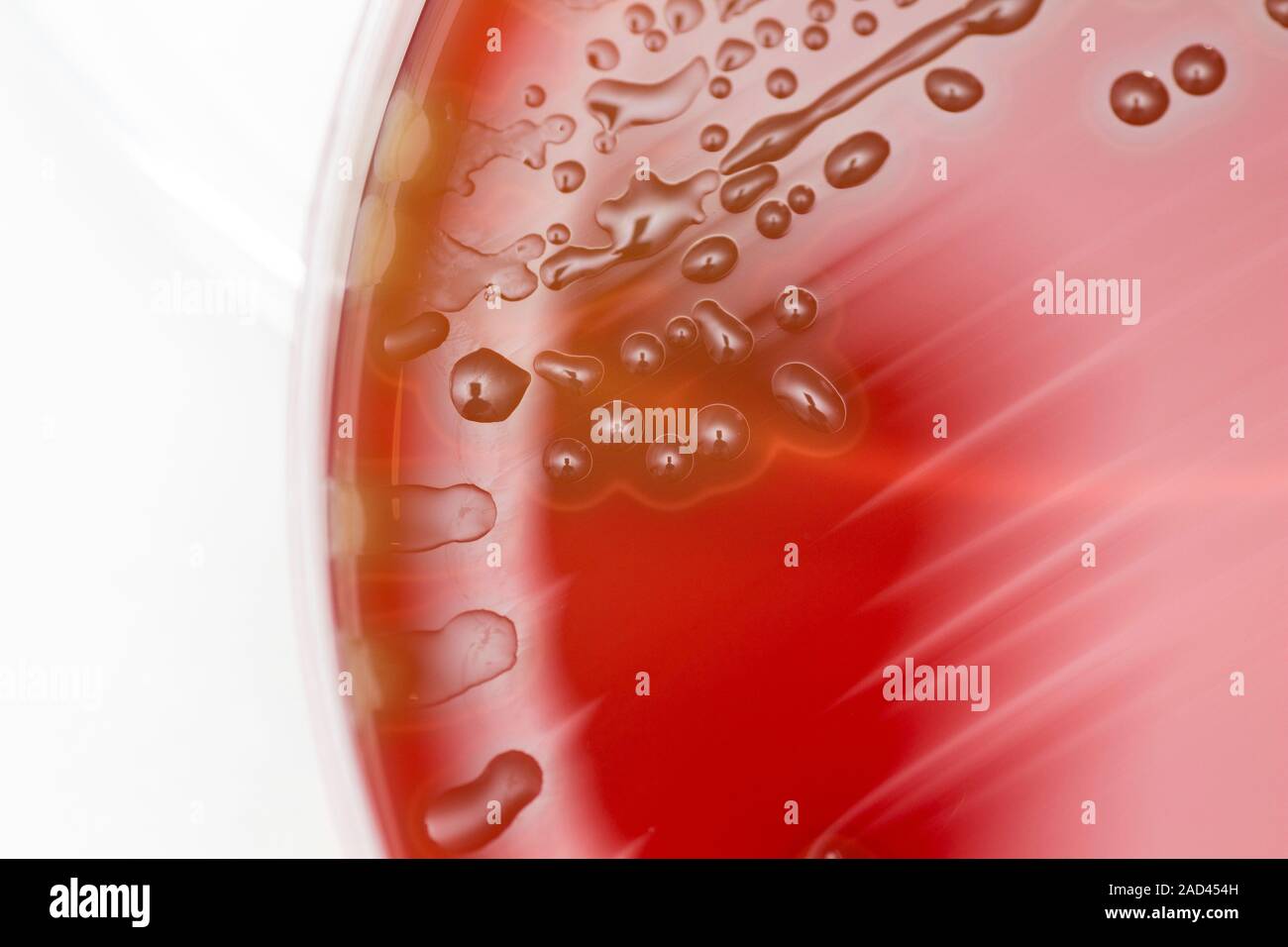 Culture de Streptococcus pneumoniae sur Columbia La gélose au sang ...