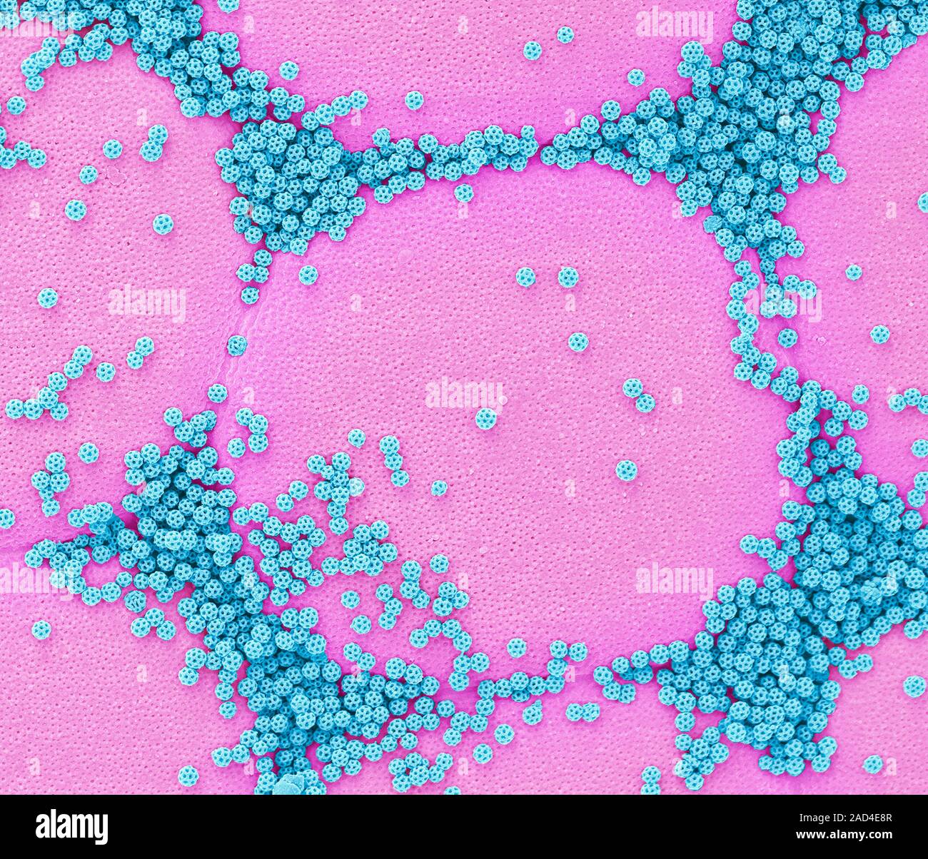 Brochosomes, couleur de l'analyse des électrons Microphotographie (SEM ...