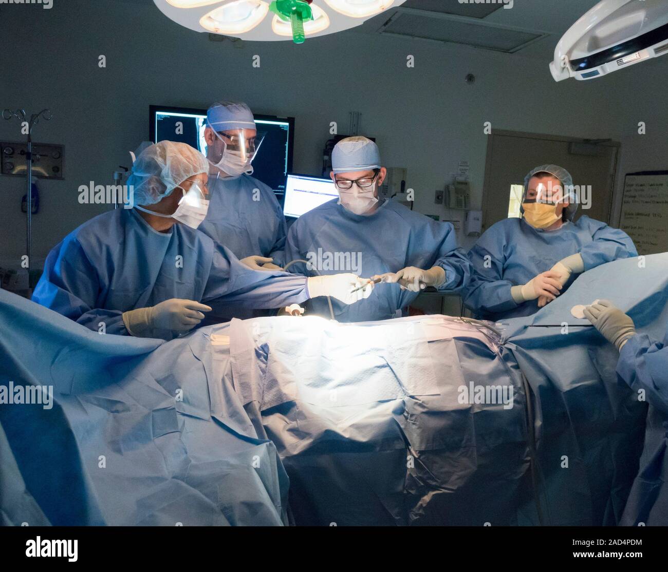La chirurgie de déplacement de l'annexe. L'enseignement aux résidents ...