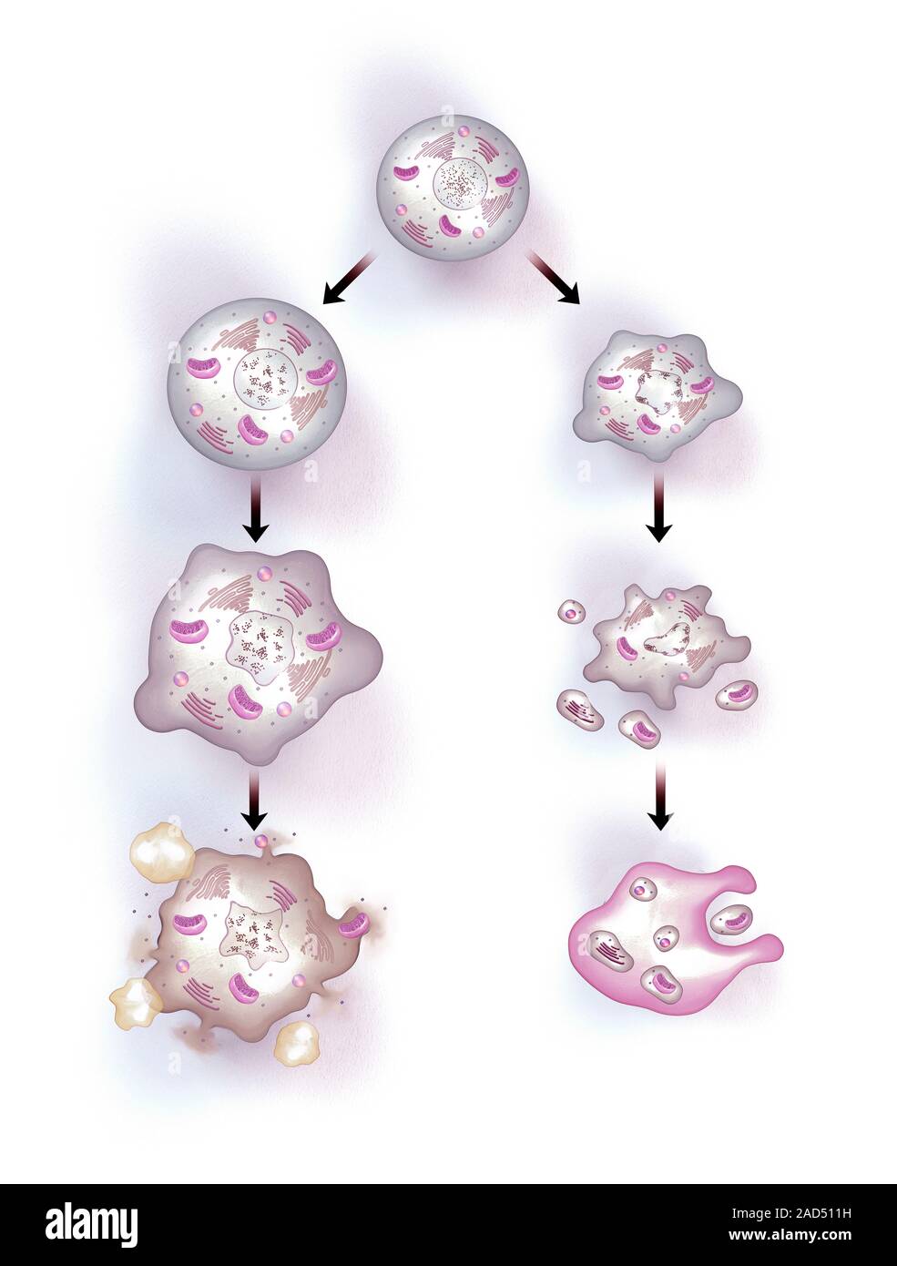 La nécrose et l'apoptose, l'illustration. Infectieuse (à gauche) est la ...