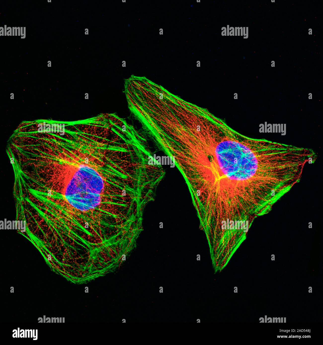 Les cellules HeLa le cancer du col. La lumière de fluorescence ...