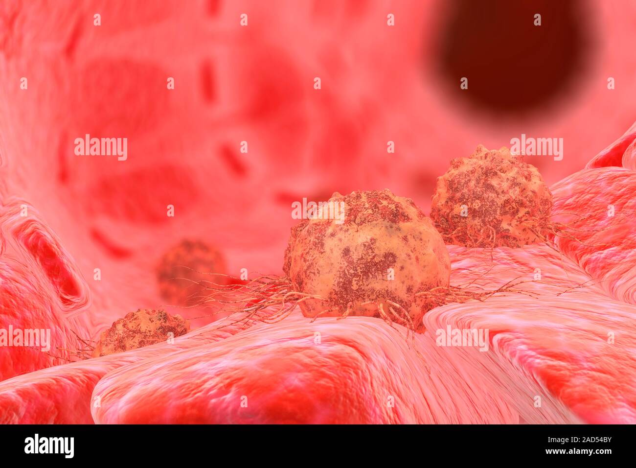 Les cellules de cancer, l'illustration de l'ordinateur. La surface ...