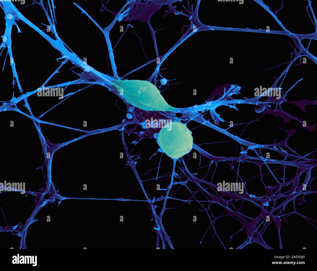 Neurones (cellules allongées) et de cellules rondes (astrocytes) du ...