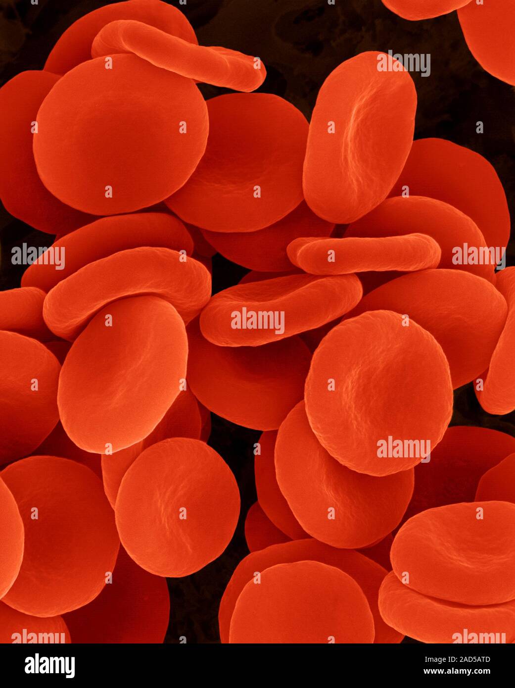 Les globules rouges dans une solution saline isotonique (0,9 % de NaCl ...