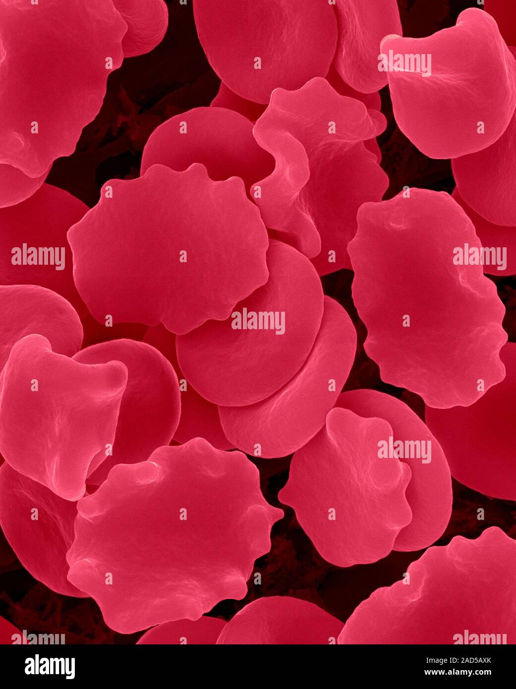 Les globules rouges dans une solution hypertonique (1,01 % de NaCl ...