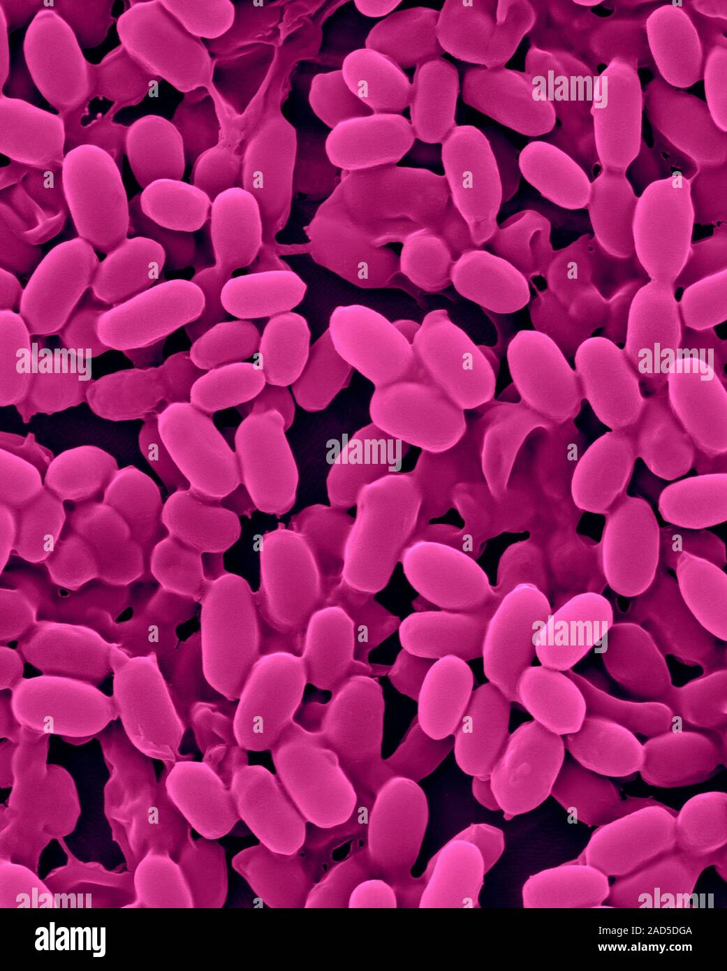 Pasteurella Multocida