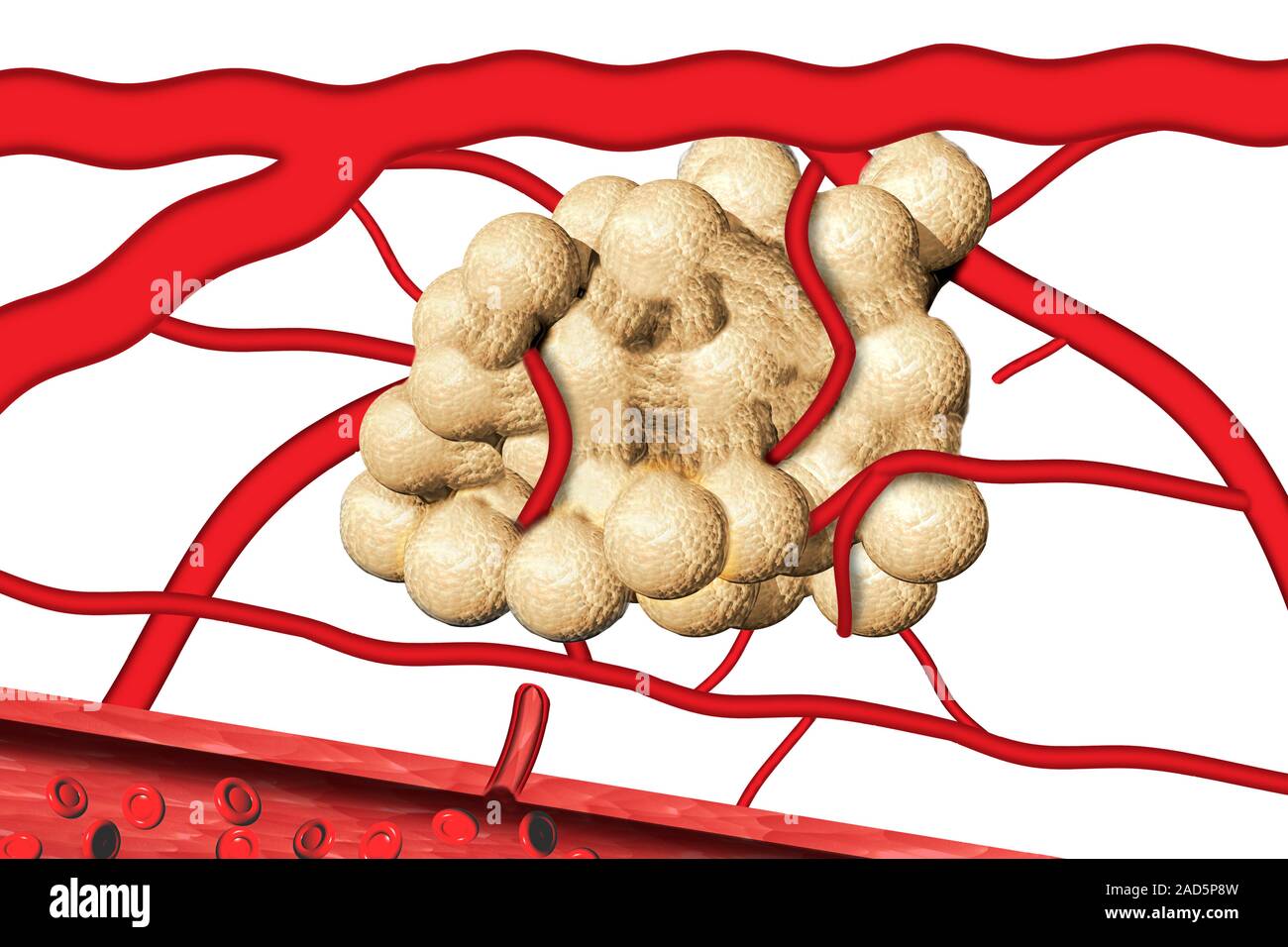 La formation des vaisseaux sanguins. Illustration montrant malignes ...