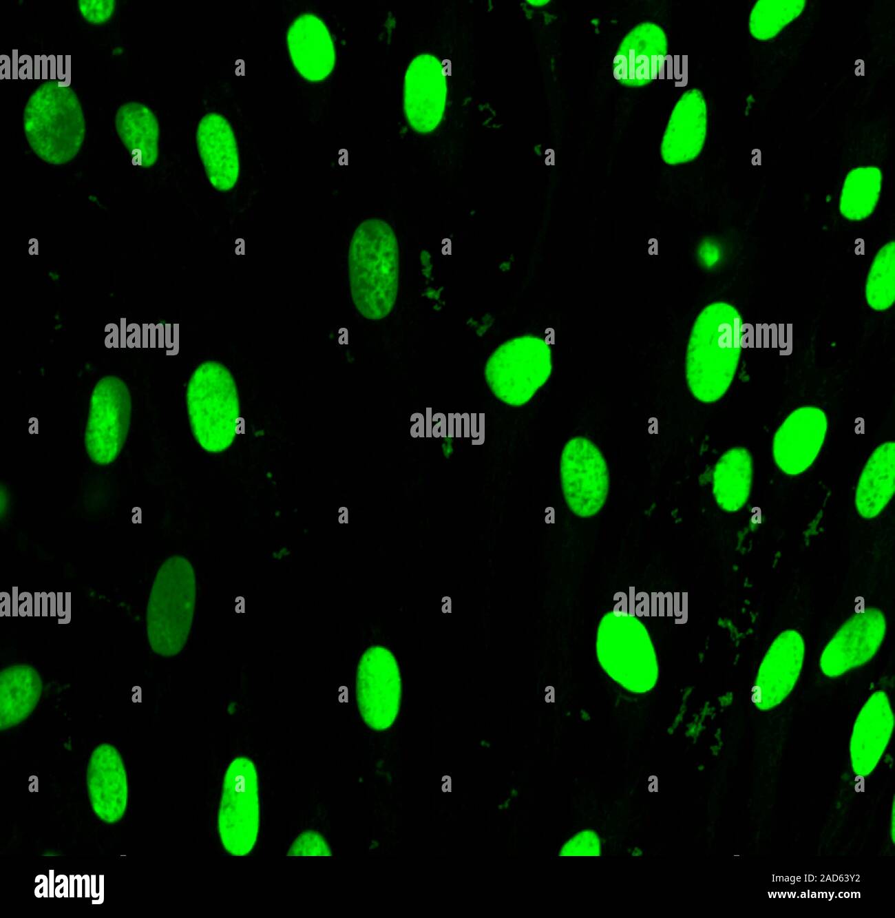 Les cellules de la peau des fibroblastes. La lumière de fluorescence ...