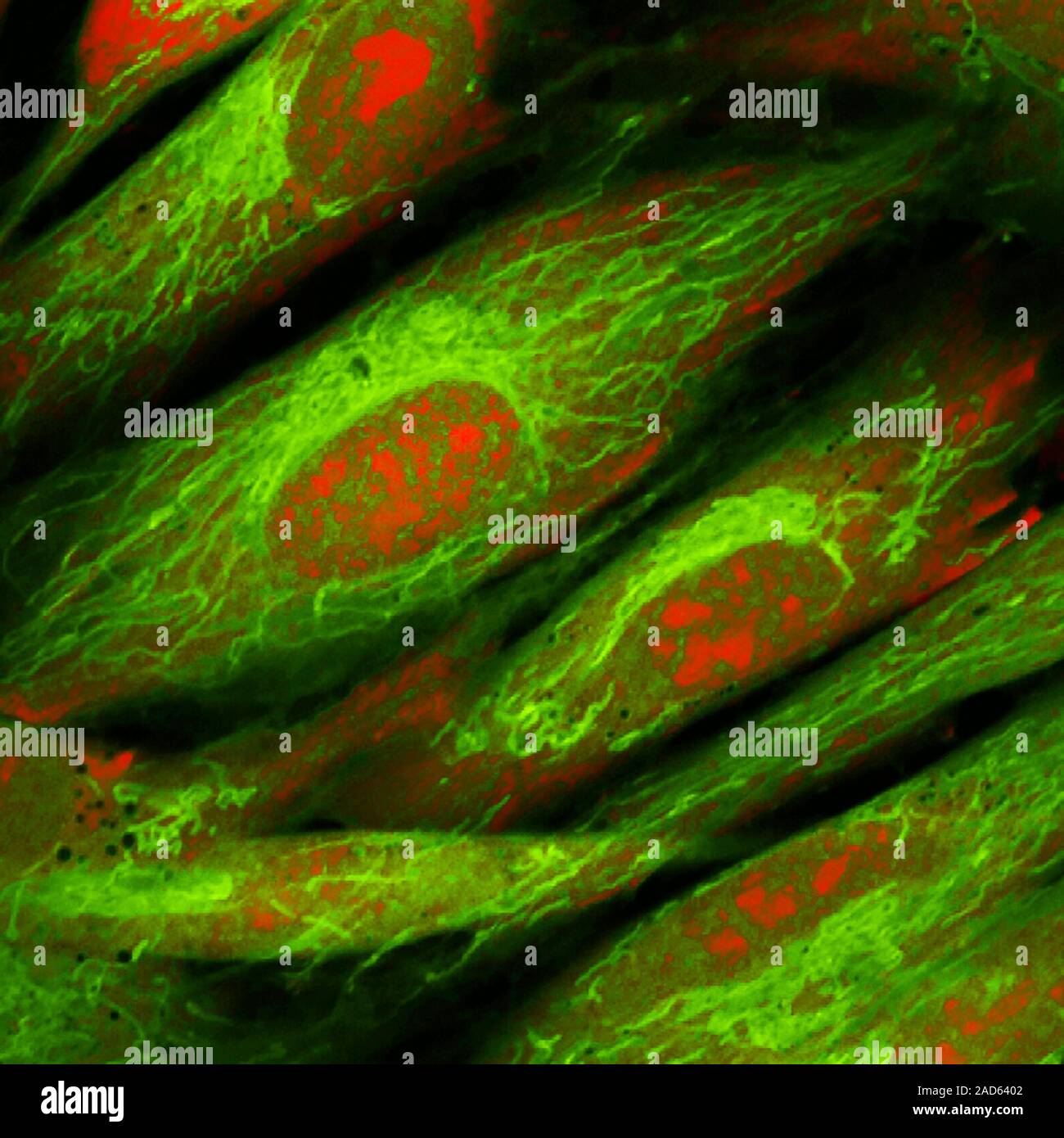 Les cellules de la peau des fibroblastes. La lumière de fluorescence ...