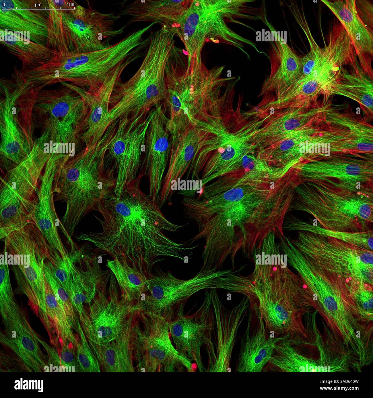 Les cellules de la peau des fibroblastes. La lumière de fluorescence ...