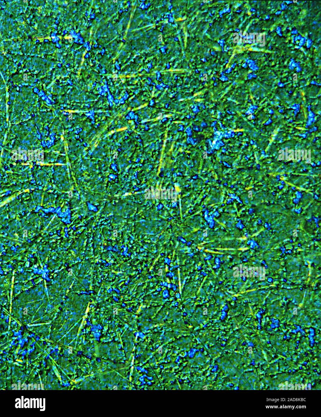 Bacteria under microscope Banque de photographies et d’images à haute ...