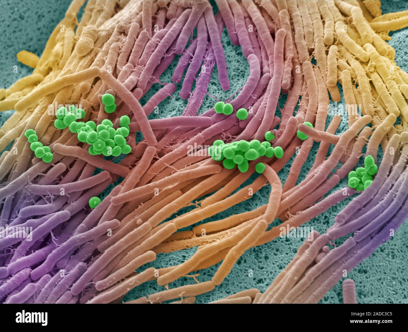 Couleur de l'analyse des électrons Microphotographie (SEM) de bactéries ...