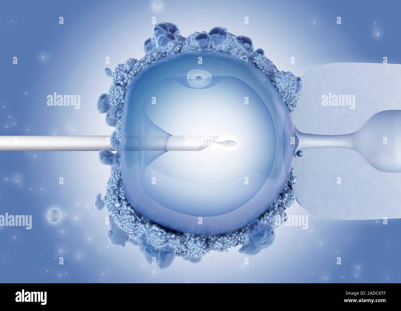 ICSI La fécondation in vitro. Illustration d'ordinateur d'un ovule ...