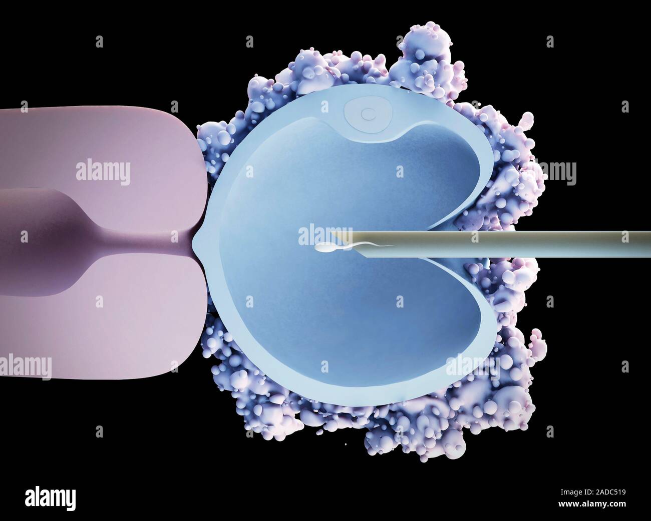 ICSI La fécondation in vitro. Illustration d'ordinateur d'un ovule ...