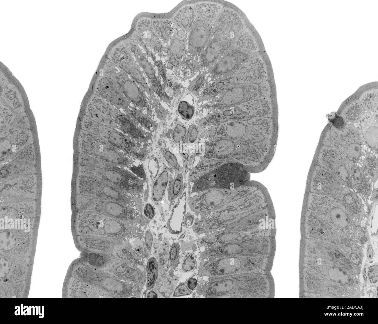 Des villosités de l'intestin grêle, micrographie électronique à ...