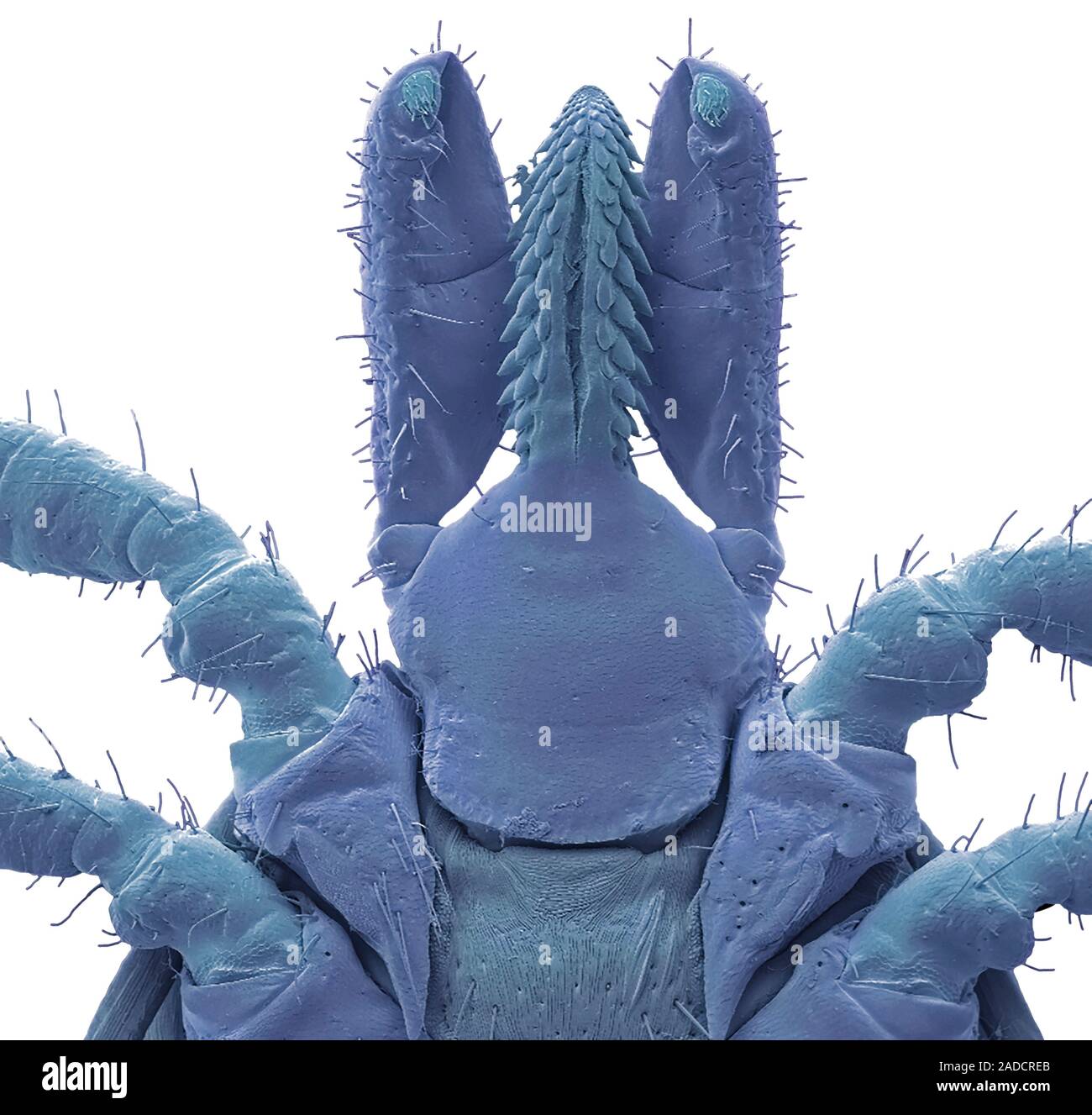 La maladie de Lyme tique (Ixodes ricinus). Micrographie électronique à ...