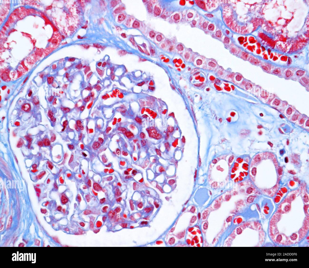 Micrograph Light Dun Glomérule Dun Rein Humain Colorées Avec Le Trichrome De Masson Les