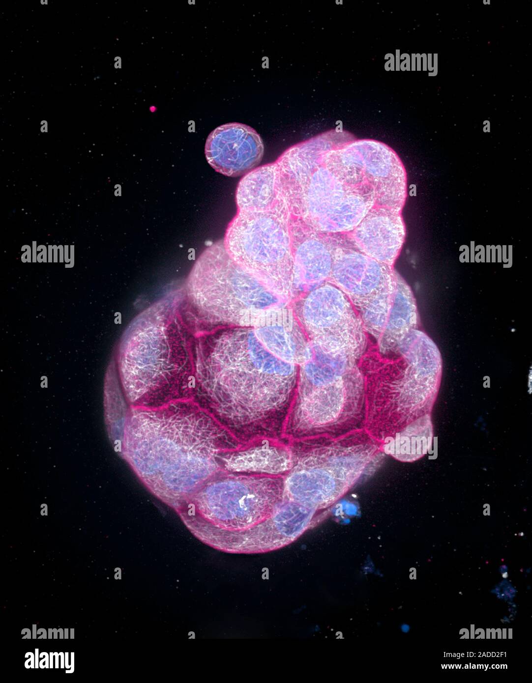 Micrographie de fluorescence des cellules du cancer du côlon en trois ...