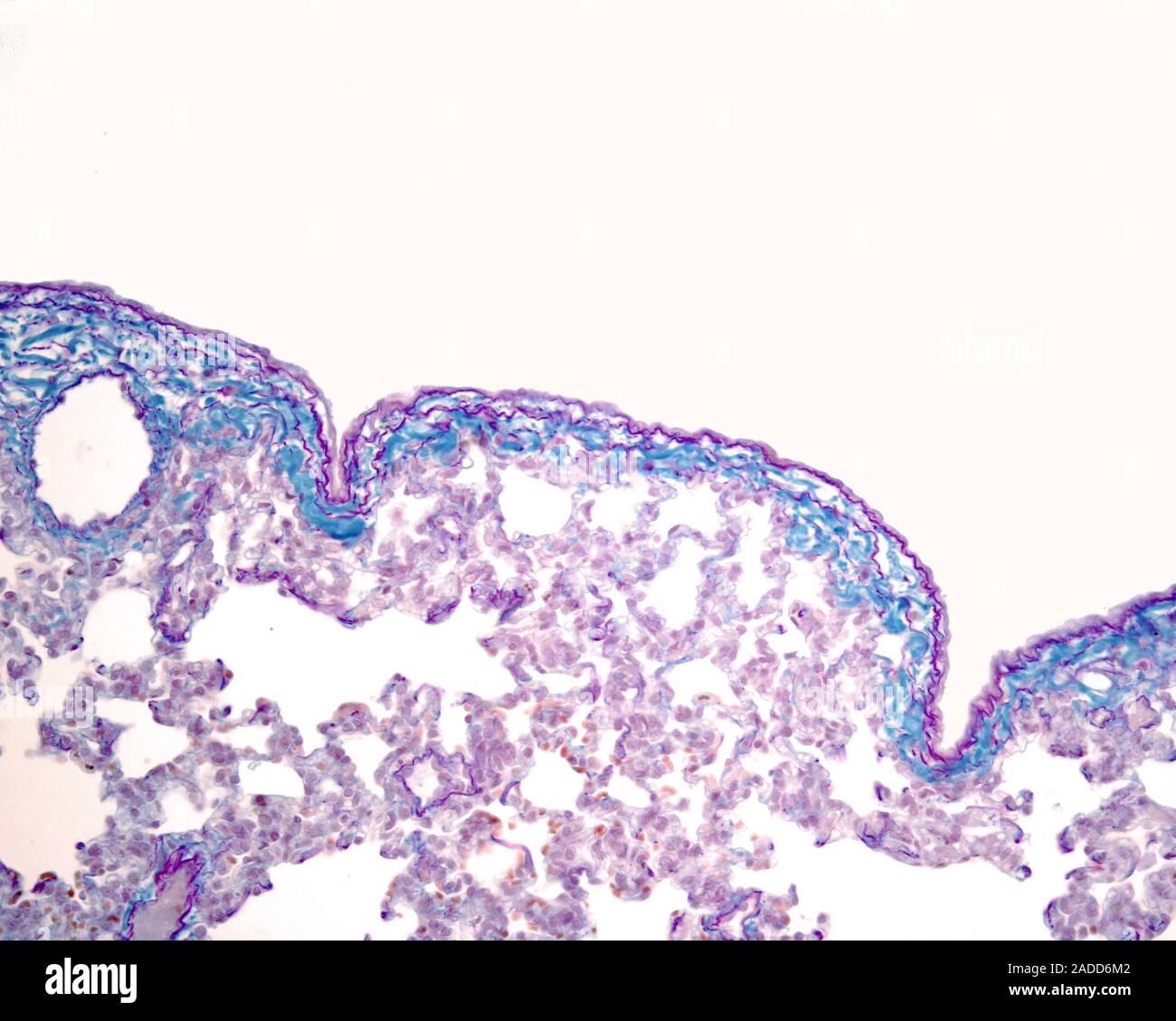 La surface de la plèvre du poumon, lumière microphotographie. C'est la ...