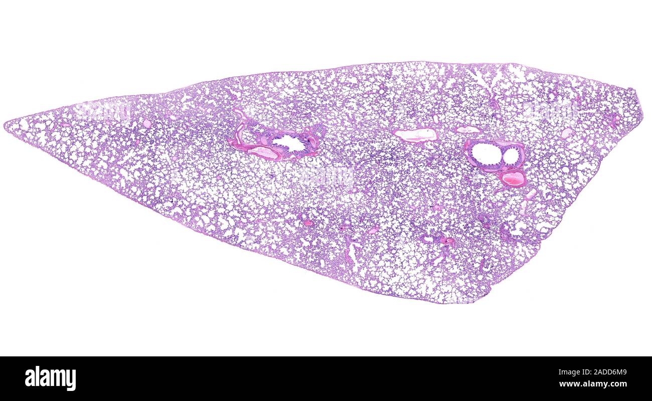 Très faible lumière d'agrandissement microphotographie montrant un ...