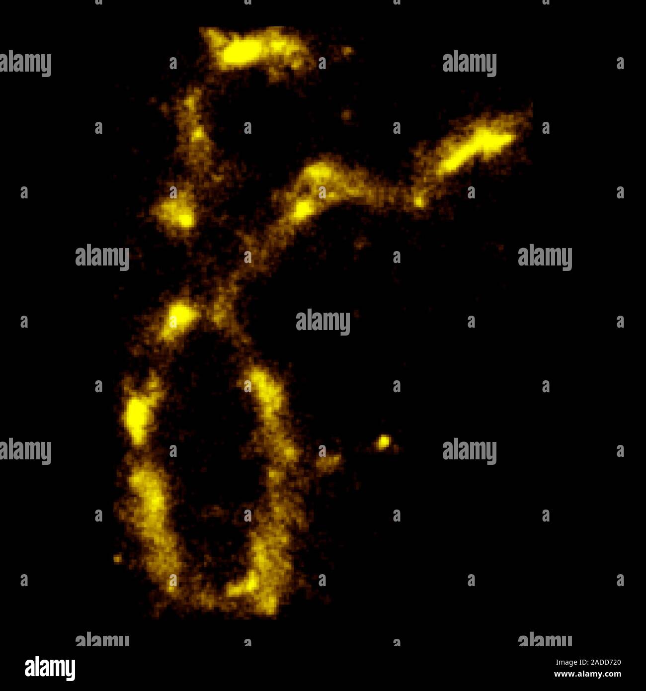 Chromosome humain. Localisation Photo microscopie (PLM) image d'un seul ...