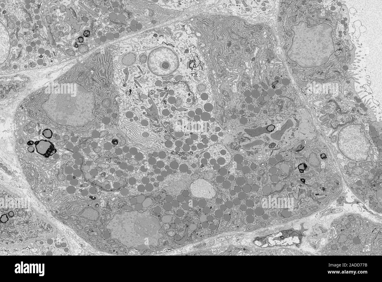 Les cellules acineuses pancréatiques, micrographie électronique à ...