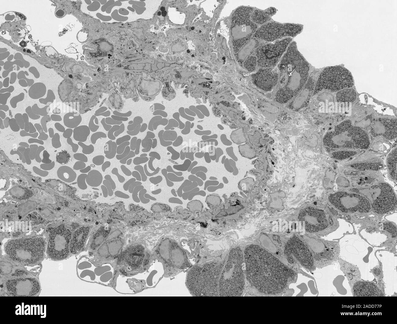 Les cellules muqueuses des poumons. Micrographie électronique à ...