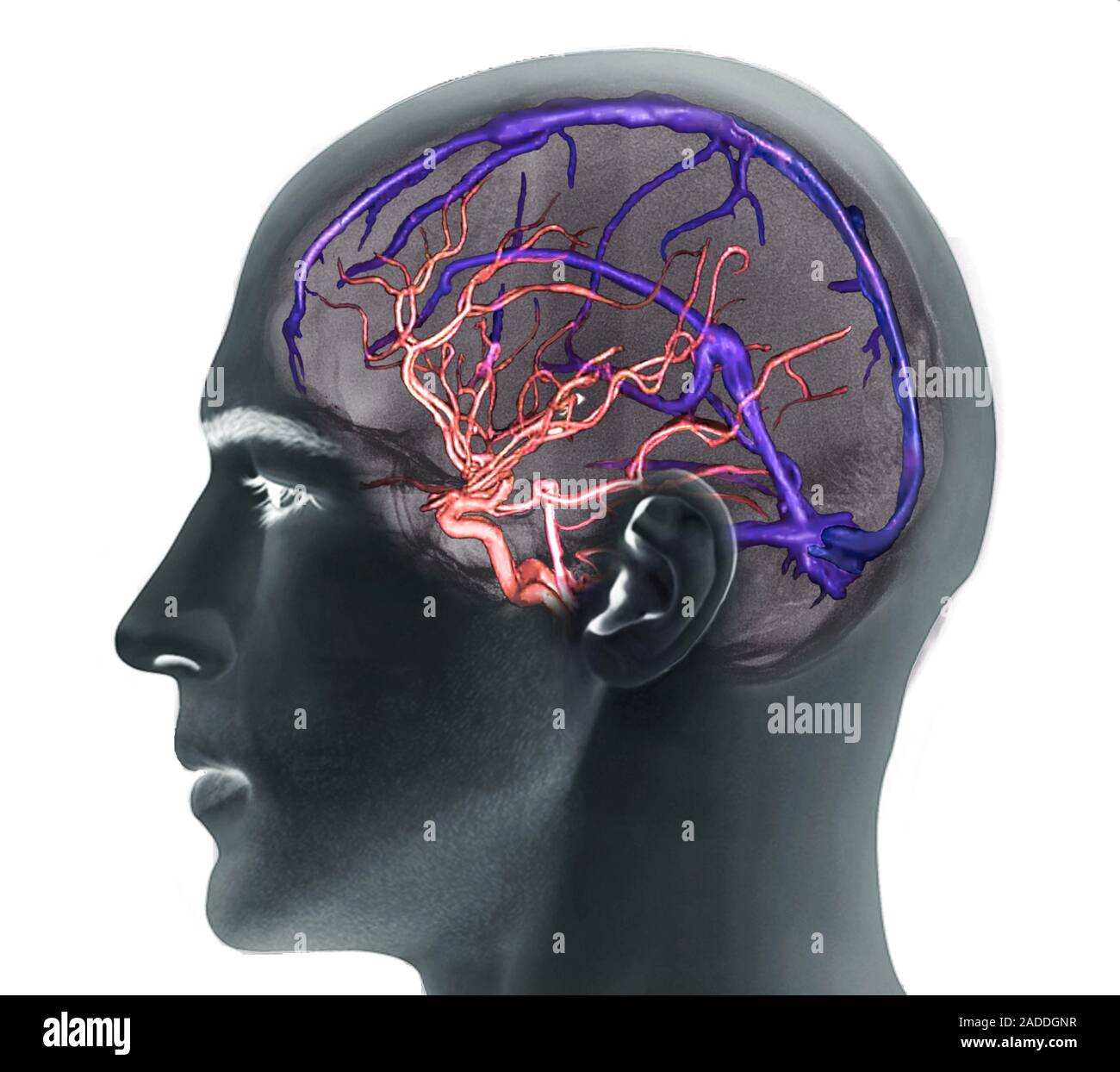 Les artères cérébrales et les sinus veineux. Latérales de couleur 3D ...