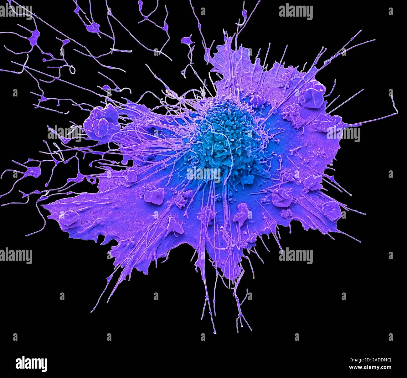 Les cellules fibroblastes. Couleur de l'analyse des électrons ...