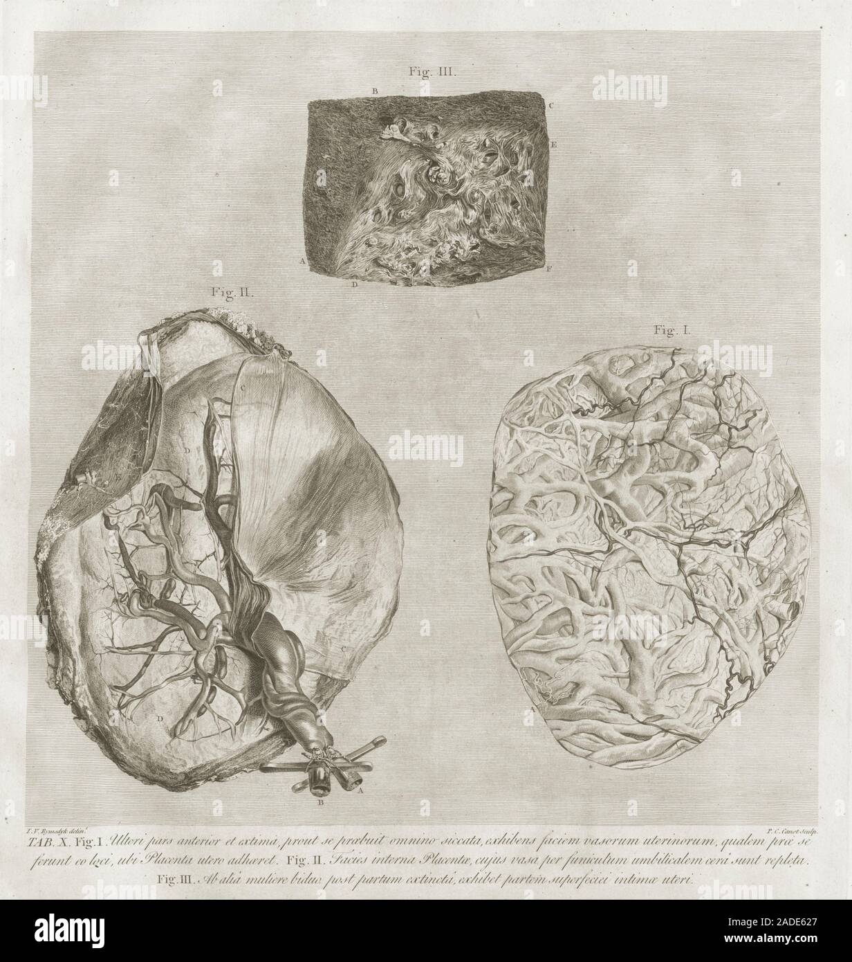 William Hunter sur l'anatomie de la femme enceinte, 1774. Cette page ...