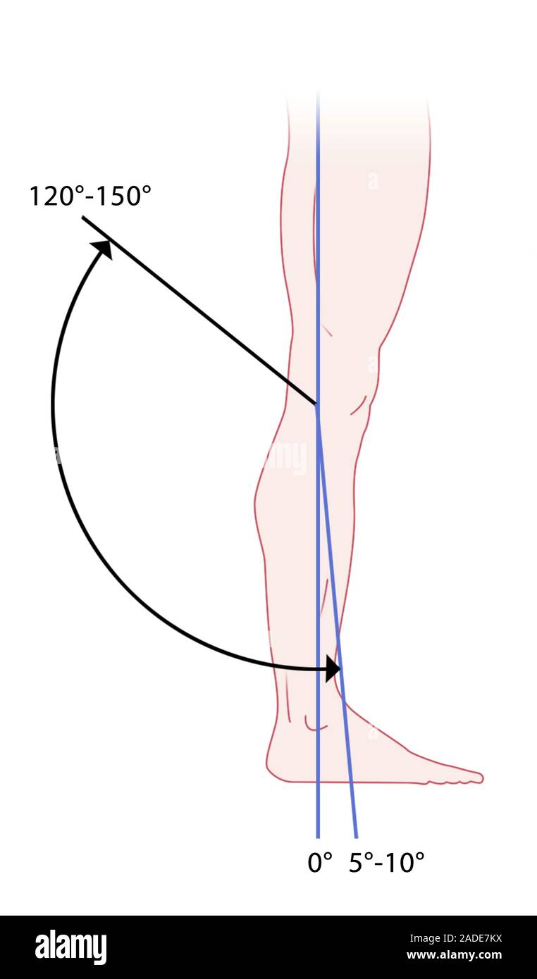 La plage de mouvement du genou. Diagramme montrant la mesure dans ...