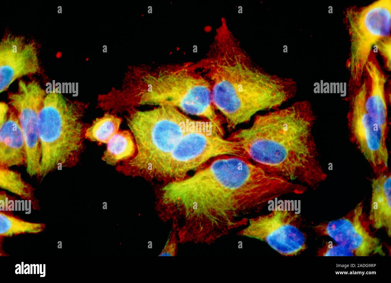Les cellules HeLa. L'immunofluorescence micrograph light d'une culture ...