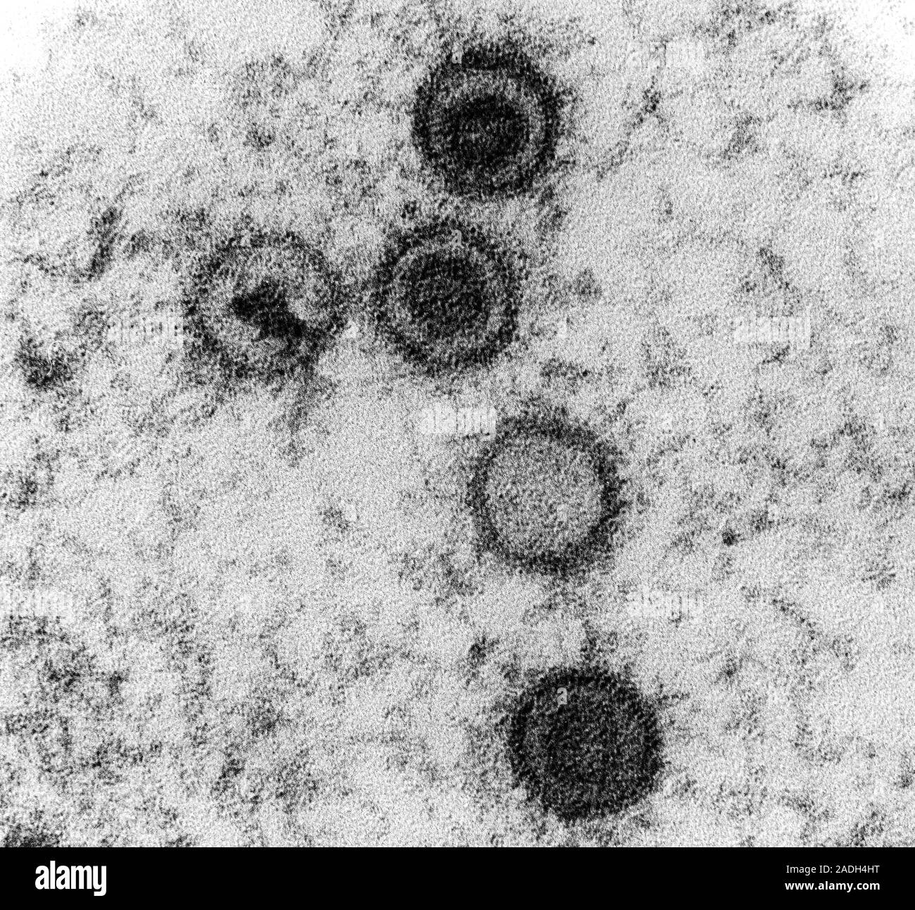 Les virus Epstein-Barr, EBV. Micrographie électronique à transmission de virus d'Epstein-Barr ...