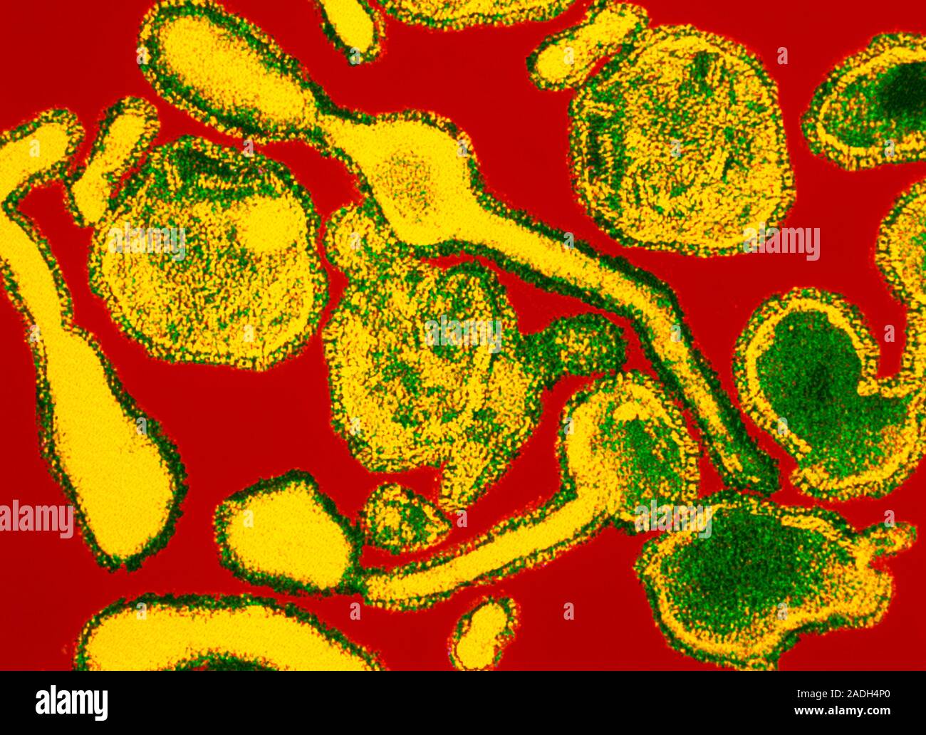 Le virus respiratoire syncytial. Micrographe colorés de virus ...
