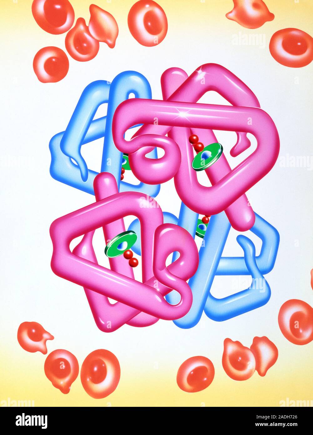 L'anémie ferriprive et l'hémoglobine. Artwork de globules rouges de ...
