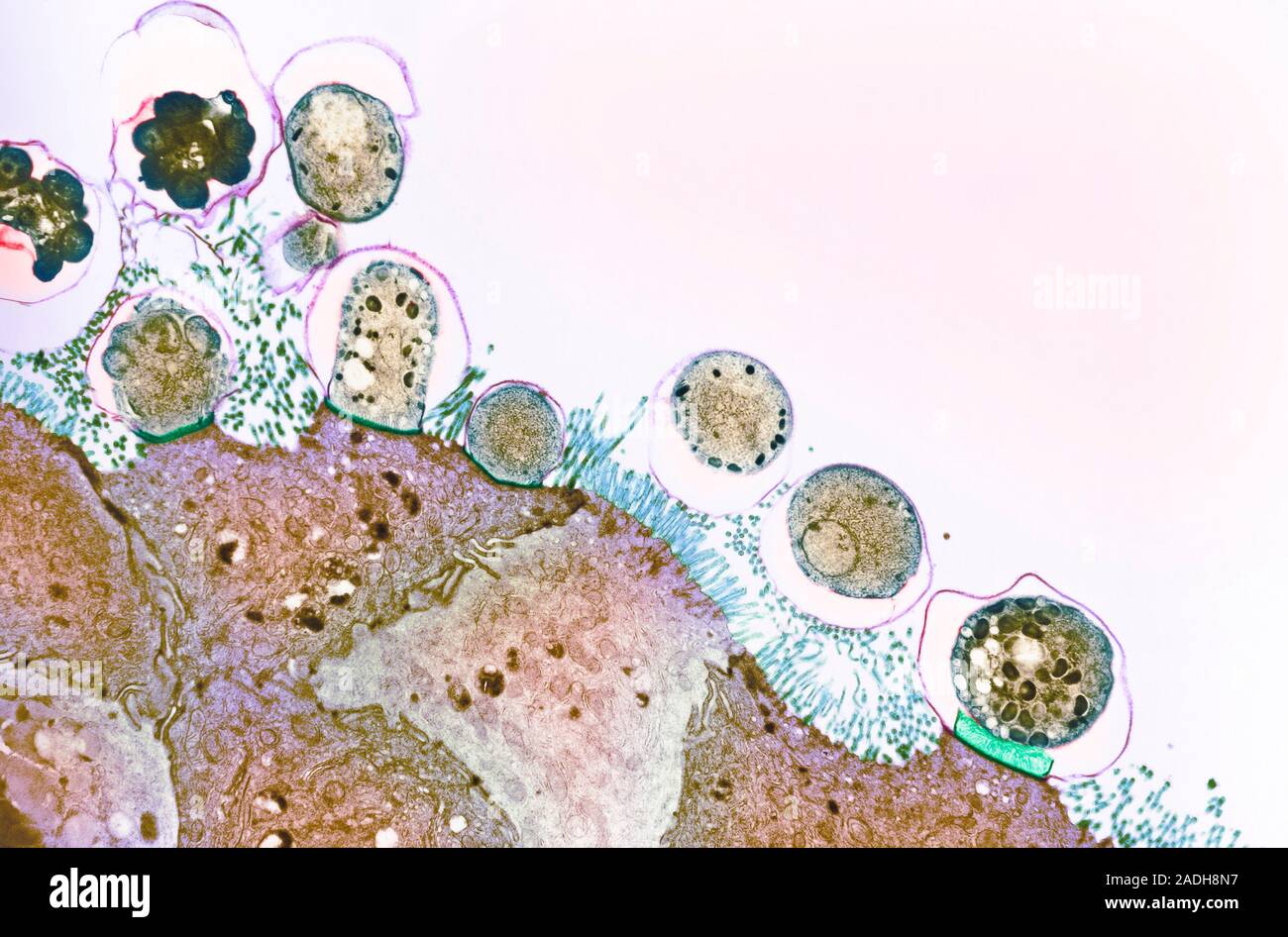La cryptosporidiose. Micrographe de couleur (TEM) d'une surface de l ...