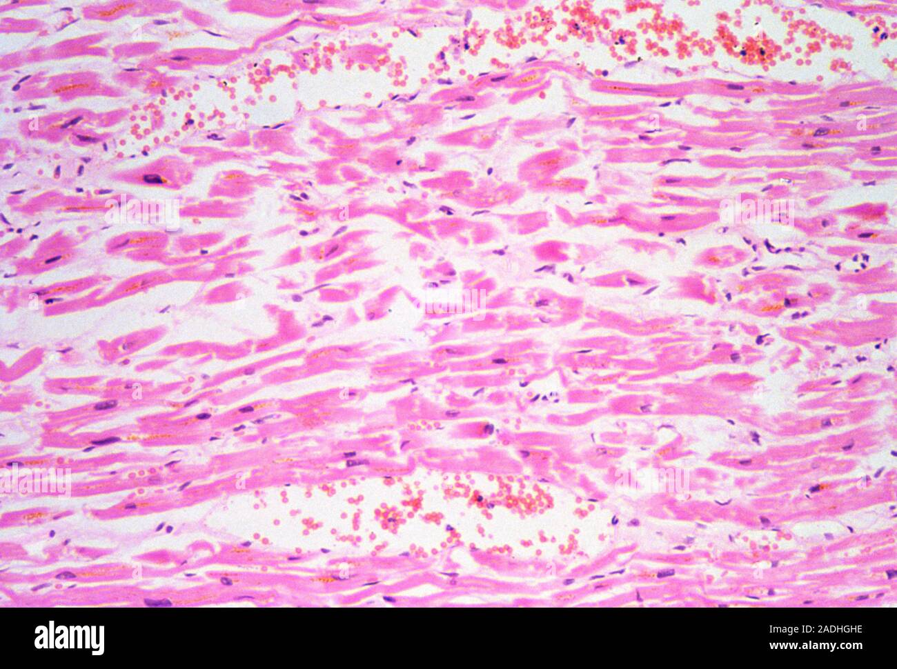 La lumière microphotographie des droits de muscle cardiaque après ...
