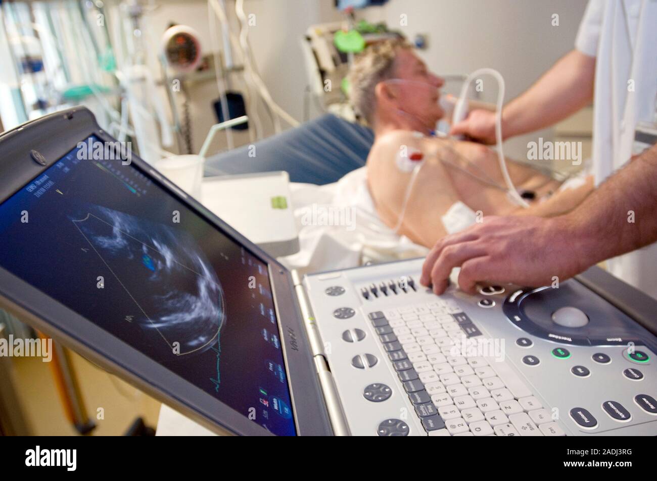 L'échographie cardiaque. Un patient ayant un échocardiogramme prises de ...