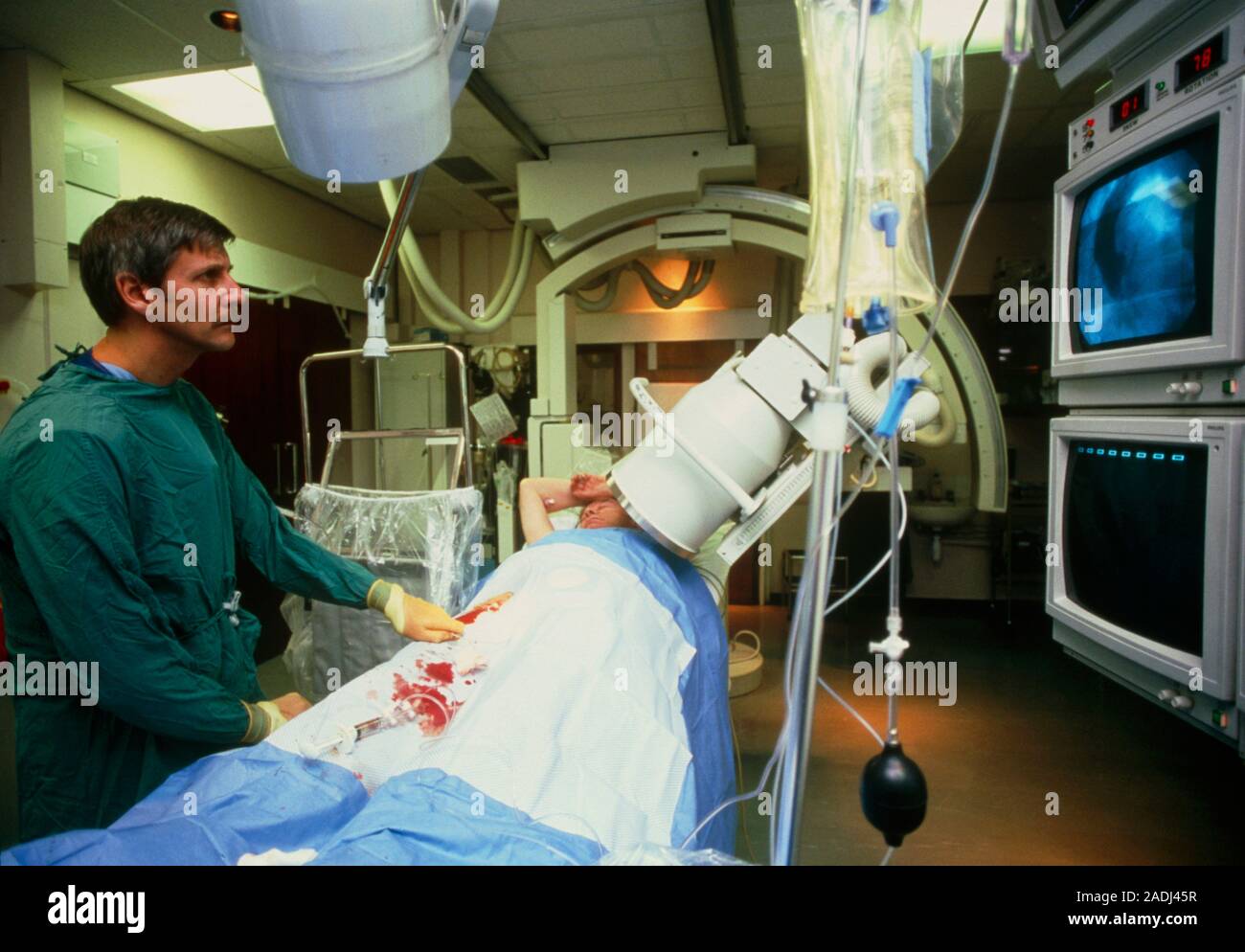 L'angiographie. L'étude de chirurgien une angiographie (coin supérieur ...