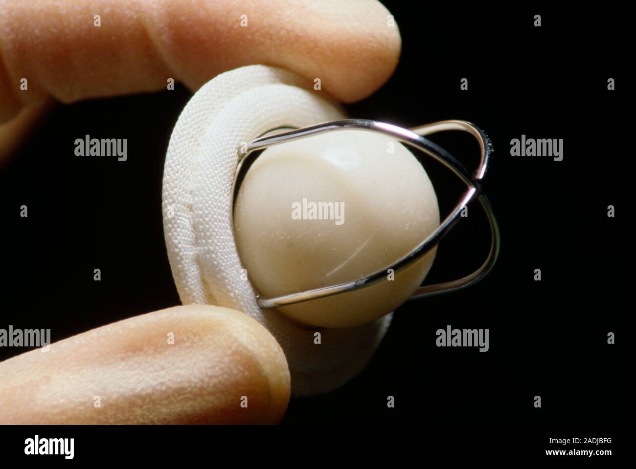 Une valve cardiaque artificielle. Main tenant une Starr-Edwards ...