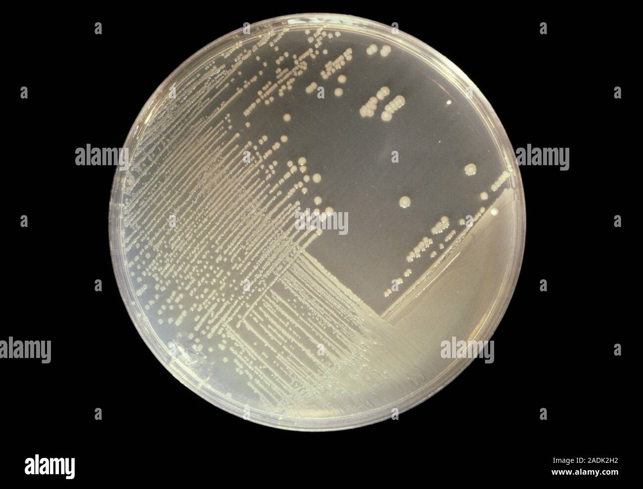 La bactérie Shigella. Colonies de Shigella dysenteriae les bactéries ...