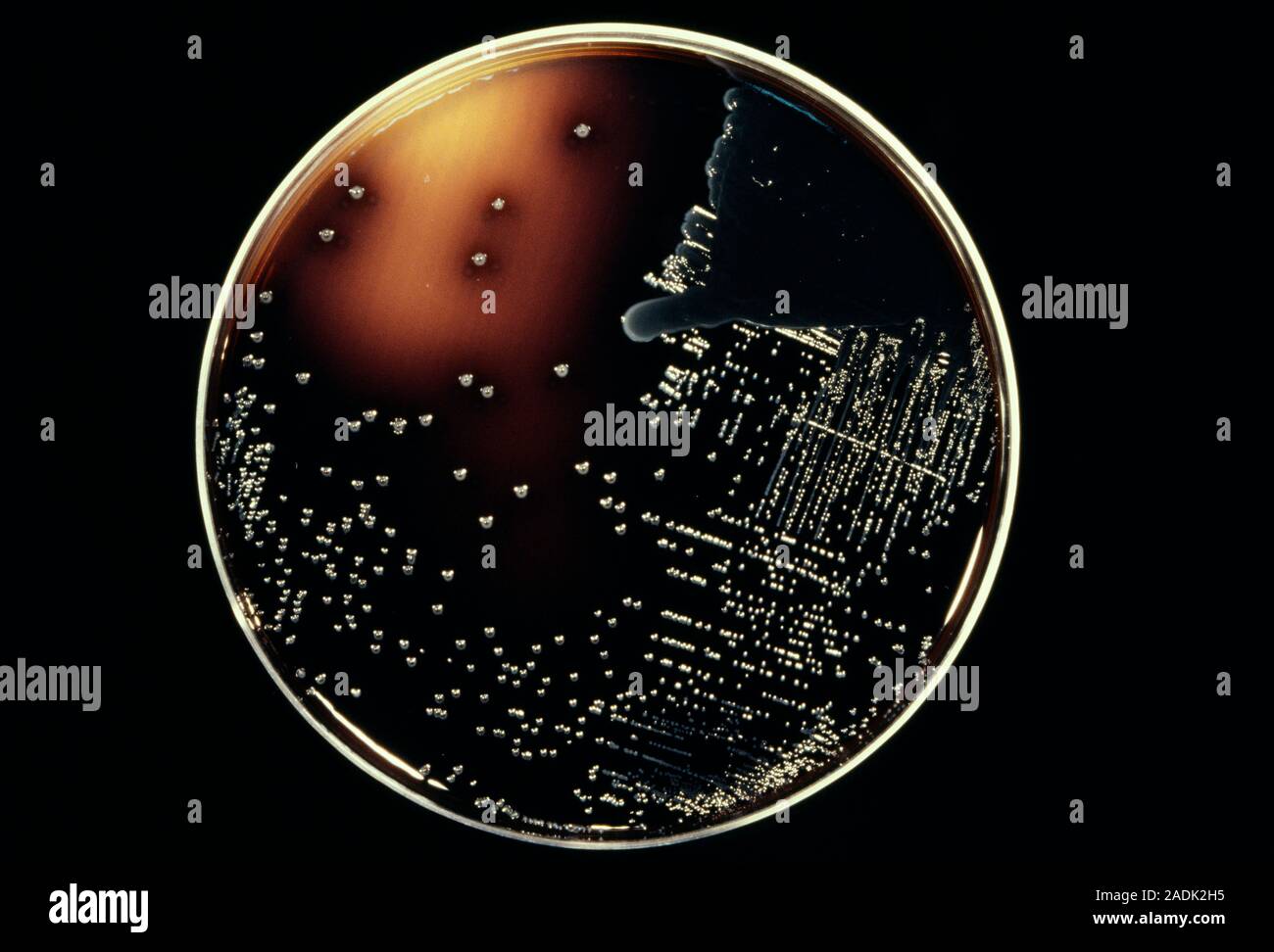 Bactéries entérocoques. Les colonies de bactéries Enterococcus faecalis ...