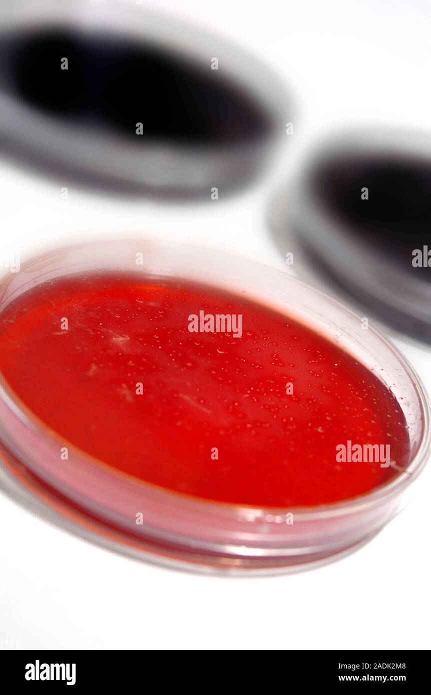 Culture bactérienne. Des boîtes de Pétri contenant de cultures de ...