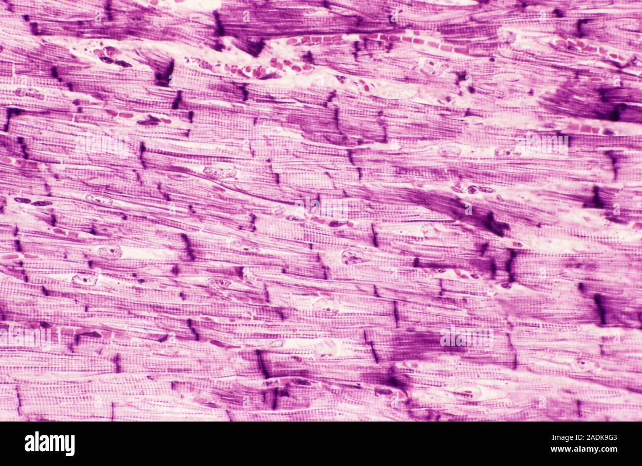 Muscle cardiaque. Microphotographie lumière d'une section longitudinale ...