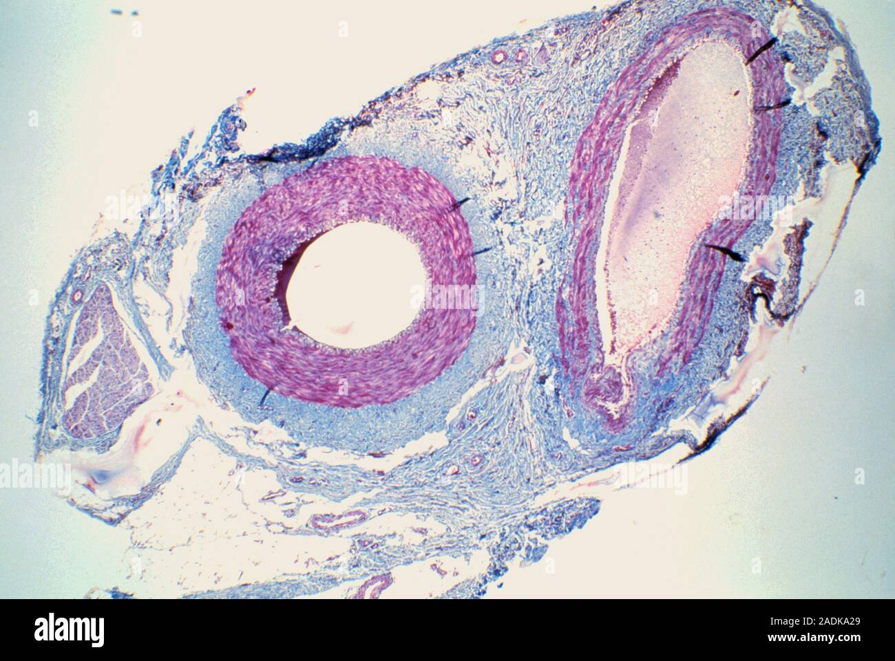 Les vaisseaux sanguins. Micrograph Light d'une section transversale à ...