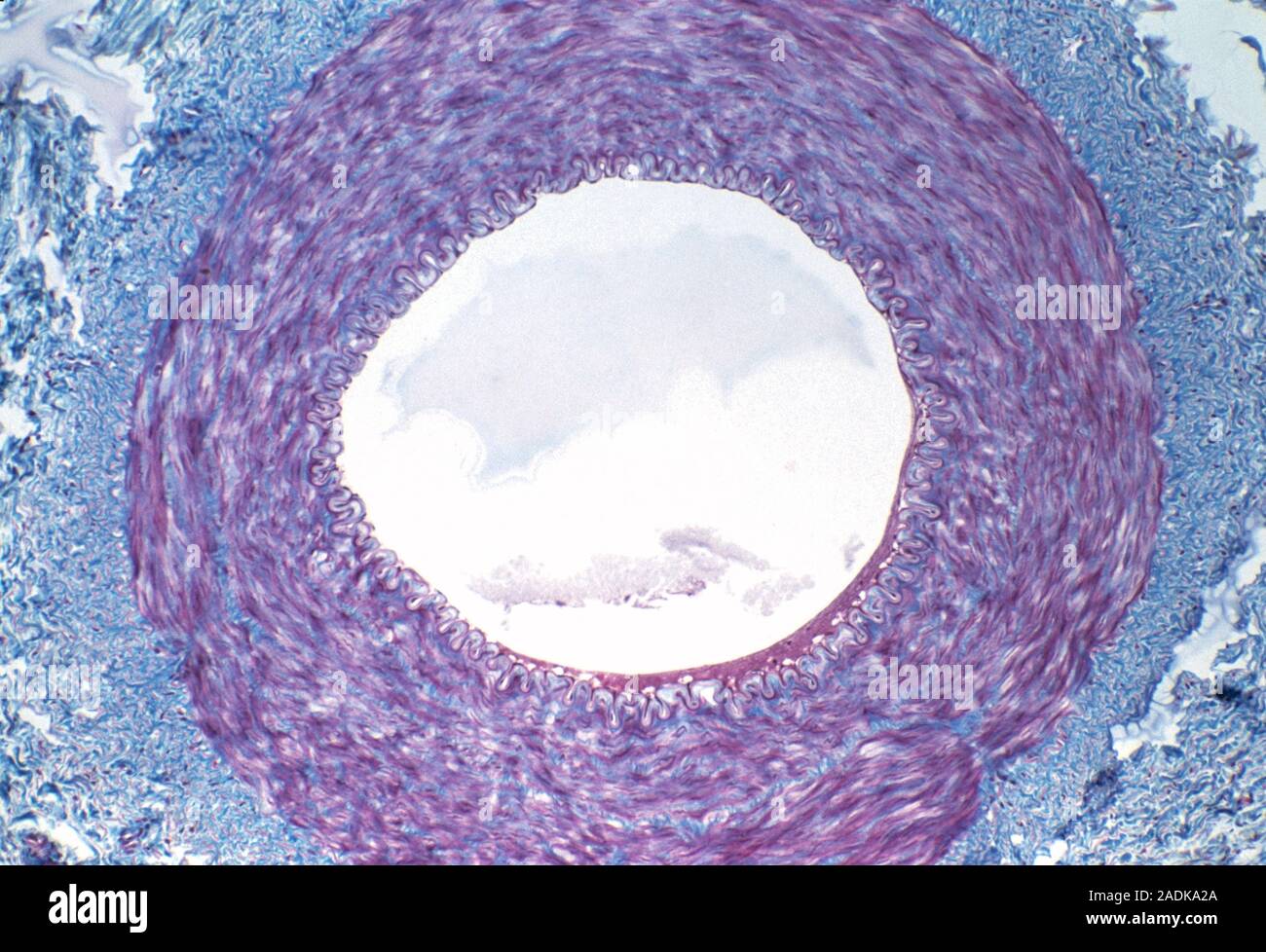 L'artère musculaire. Micrograph Light d'une section transversale à ...