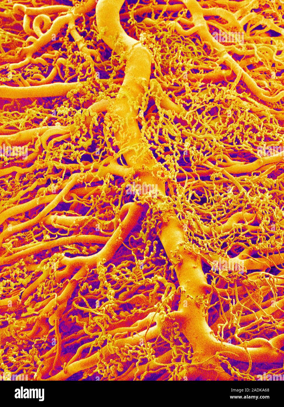 Les vaisseaux sanguins. Couleur de l'analyse des électrons ...